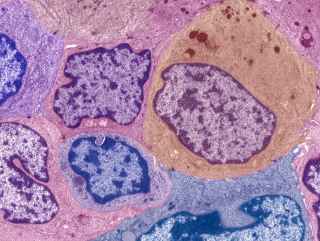 What Is a Lumpectomy and What to Expect