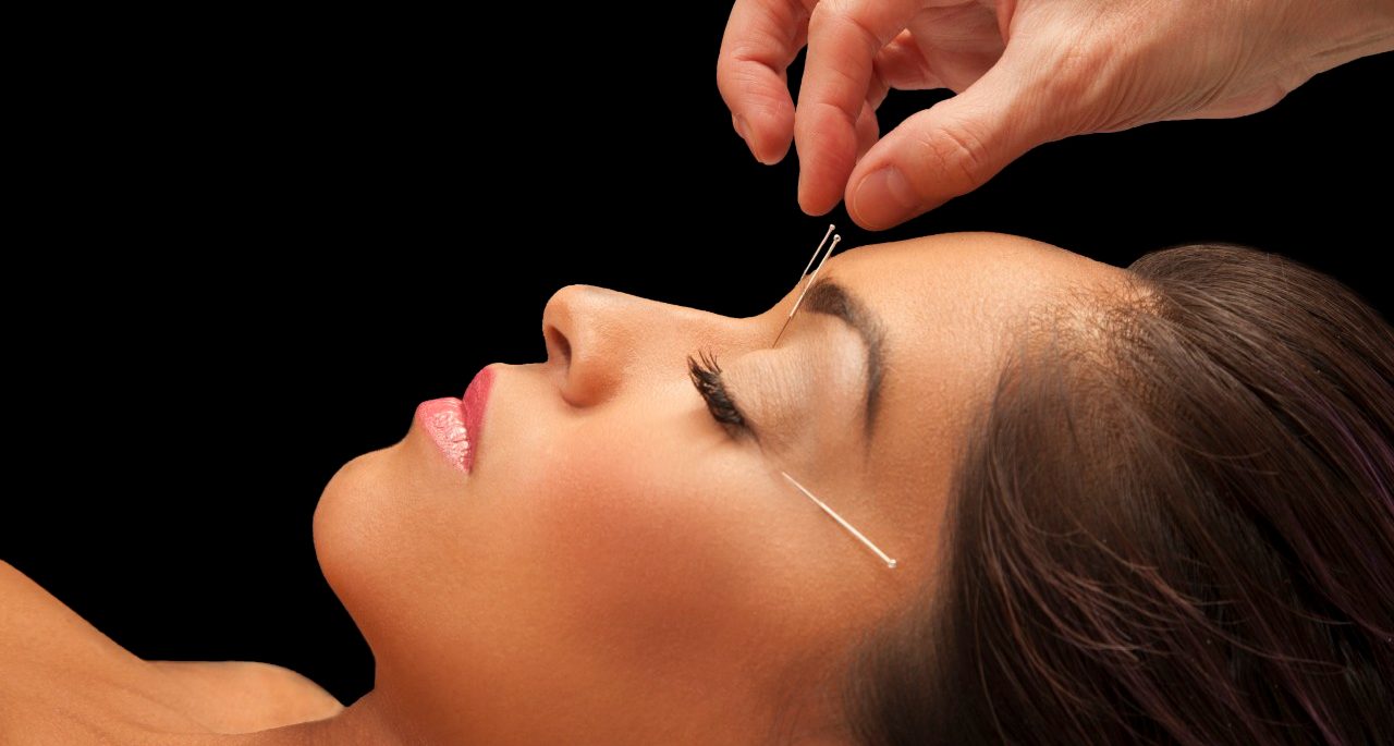 Acupuncture for Hot Flashes in Cancer Patients | YourCareEverywhere