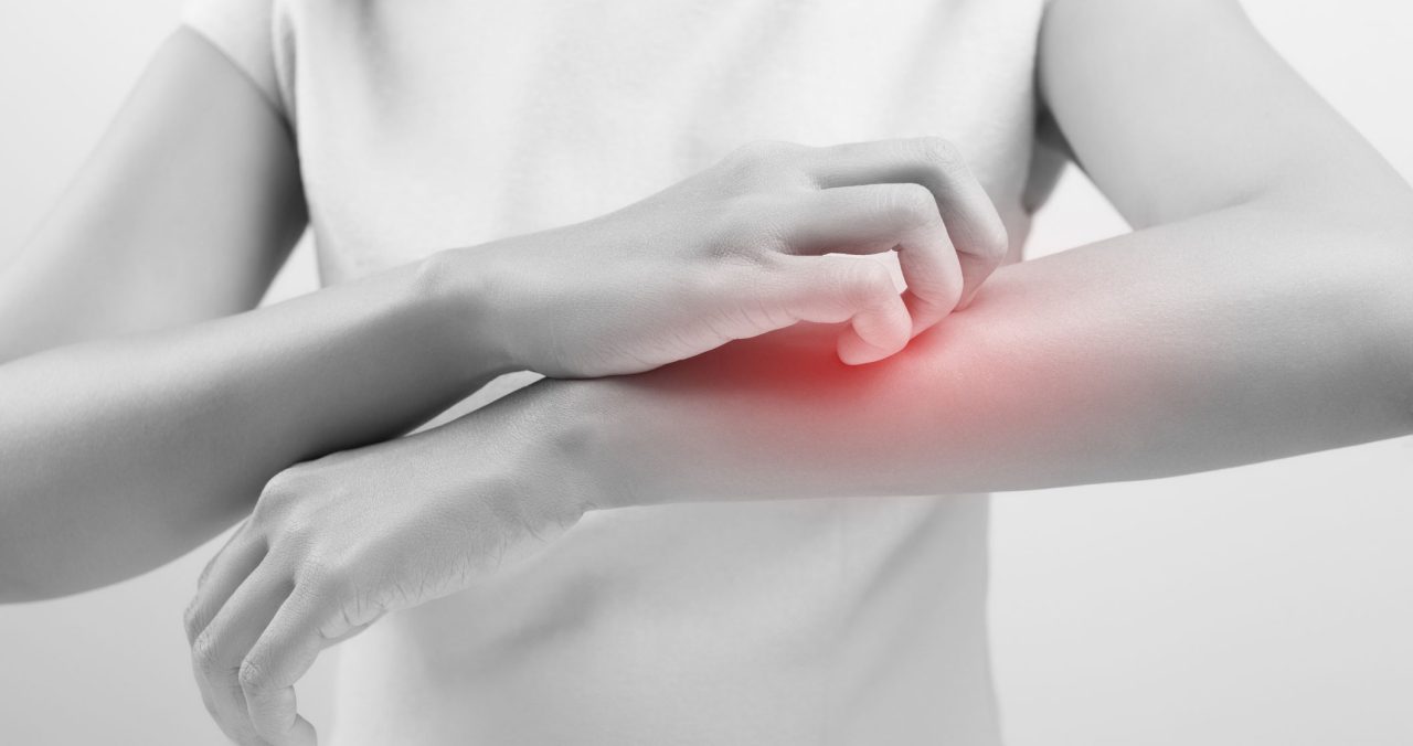 How Do You Get Cellulitis? | YourCareEverywhere